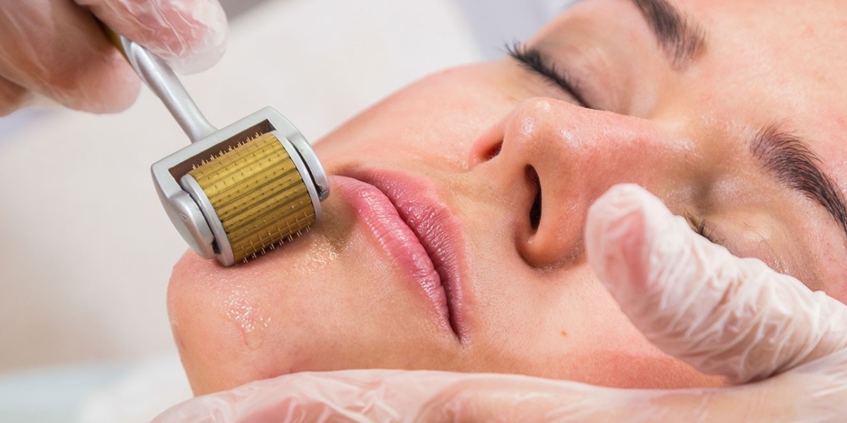 Derma-roller | Flourish Clinic